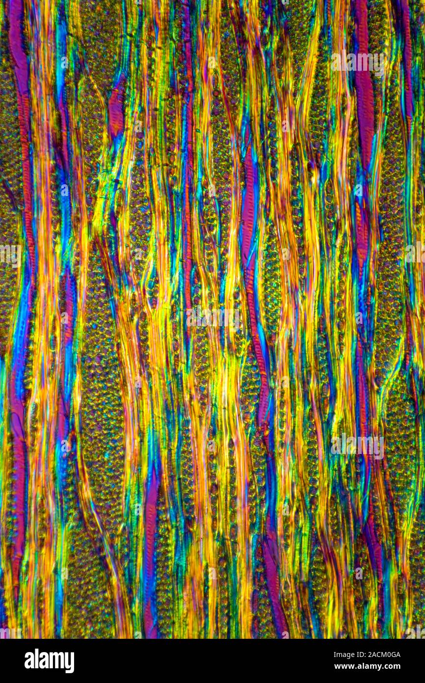 Beech tree stem. Polarised light micrograph of a section through the ...
