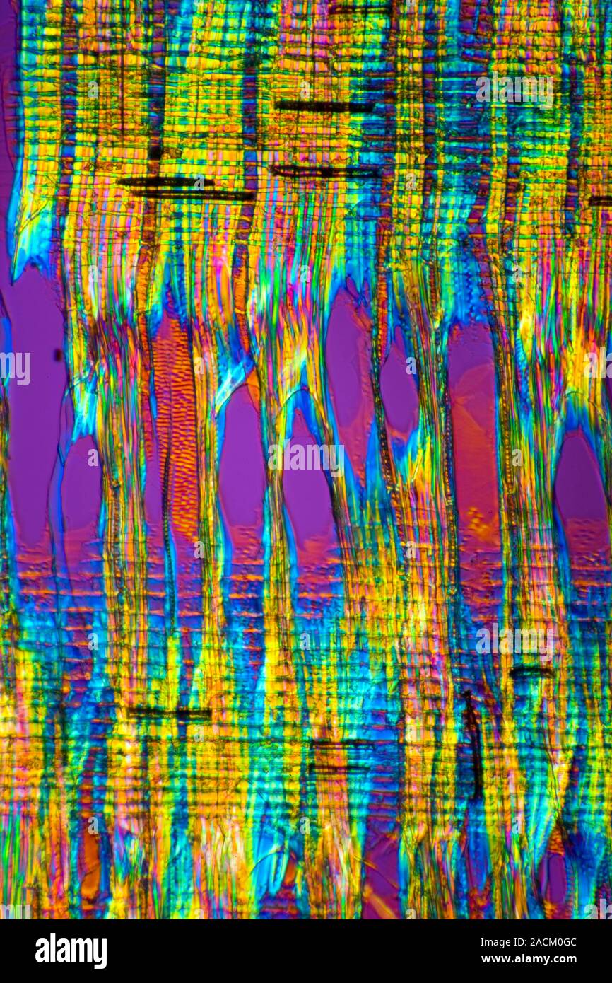 Beech tree stem. Polarised light micrograph of a section through the ...