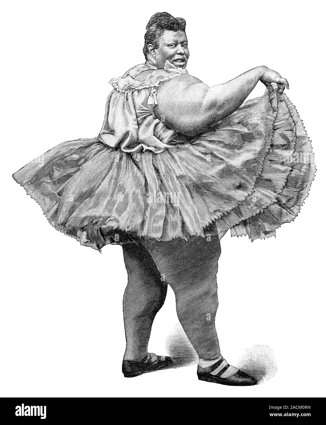 Obese woman, 19th-century artwork. Obese people were included in ...