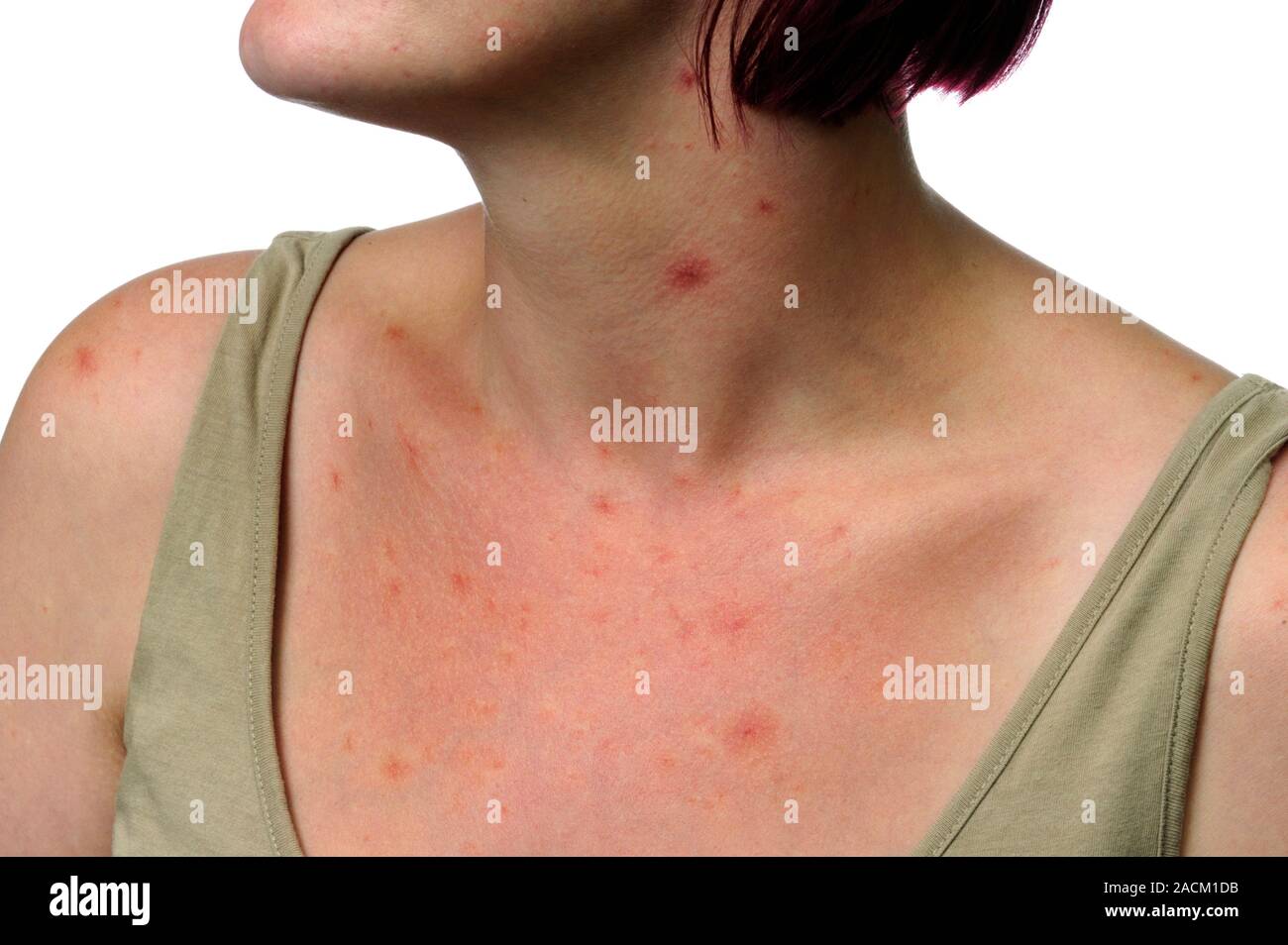 Not for use in Television Not for use in Television Red markings of ...