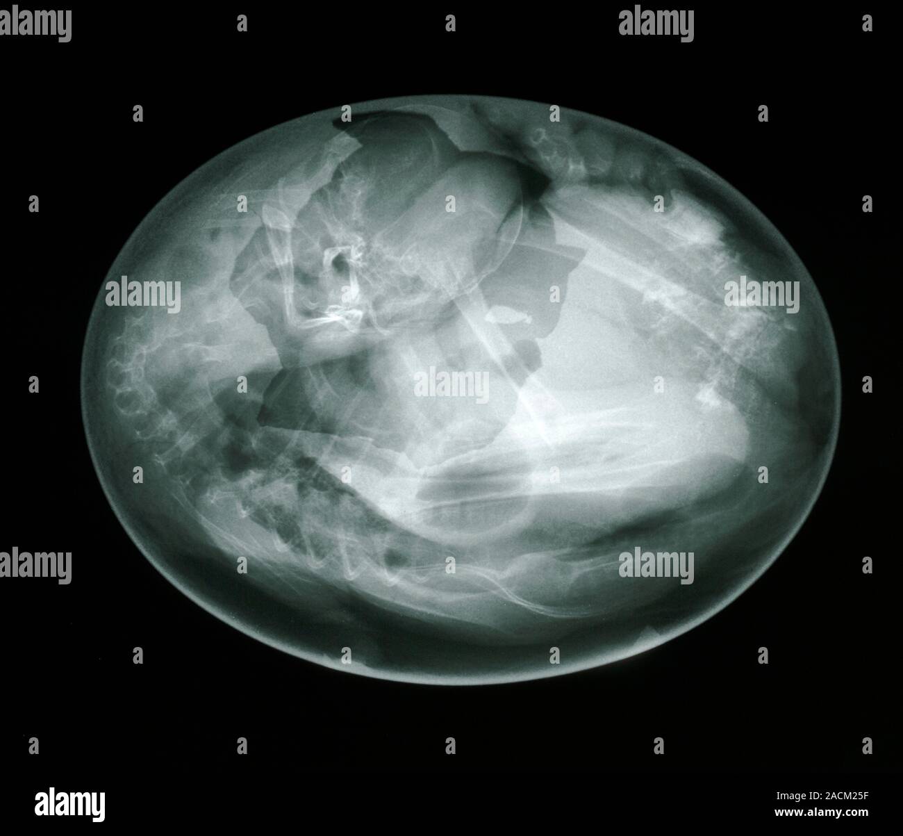 Bird egg and embryo. X-ray of an egg with an 18-day-old bird embryo ...