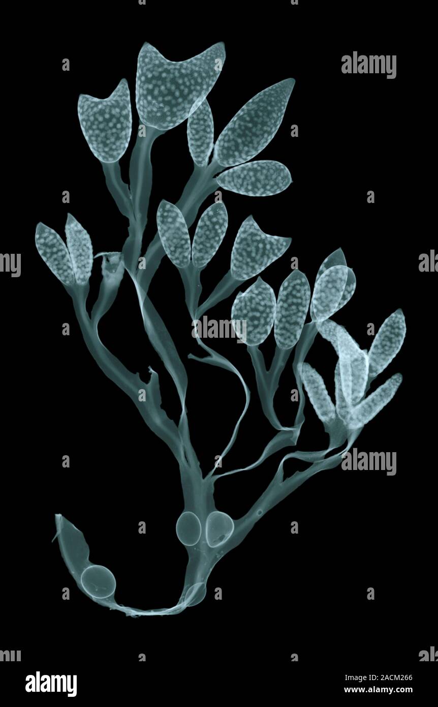Seaweed, coloured X-ray. Seaweeds are marine algae which live in ...