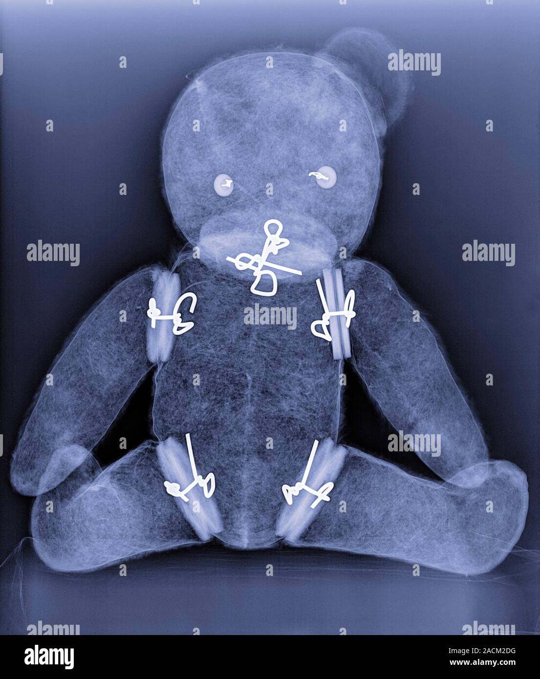 Teddy bear, X-ray Stock Photo - Alamy