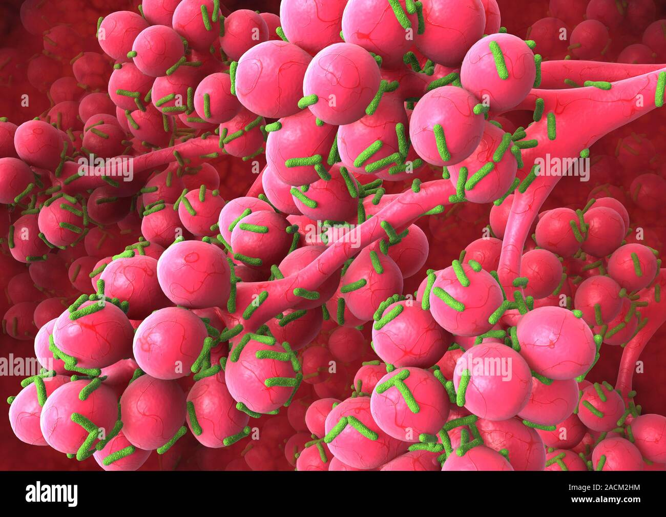 Bacterial lung infection. Computer artwork showing rod-shaped bacteria ...