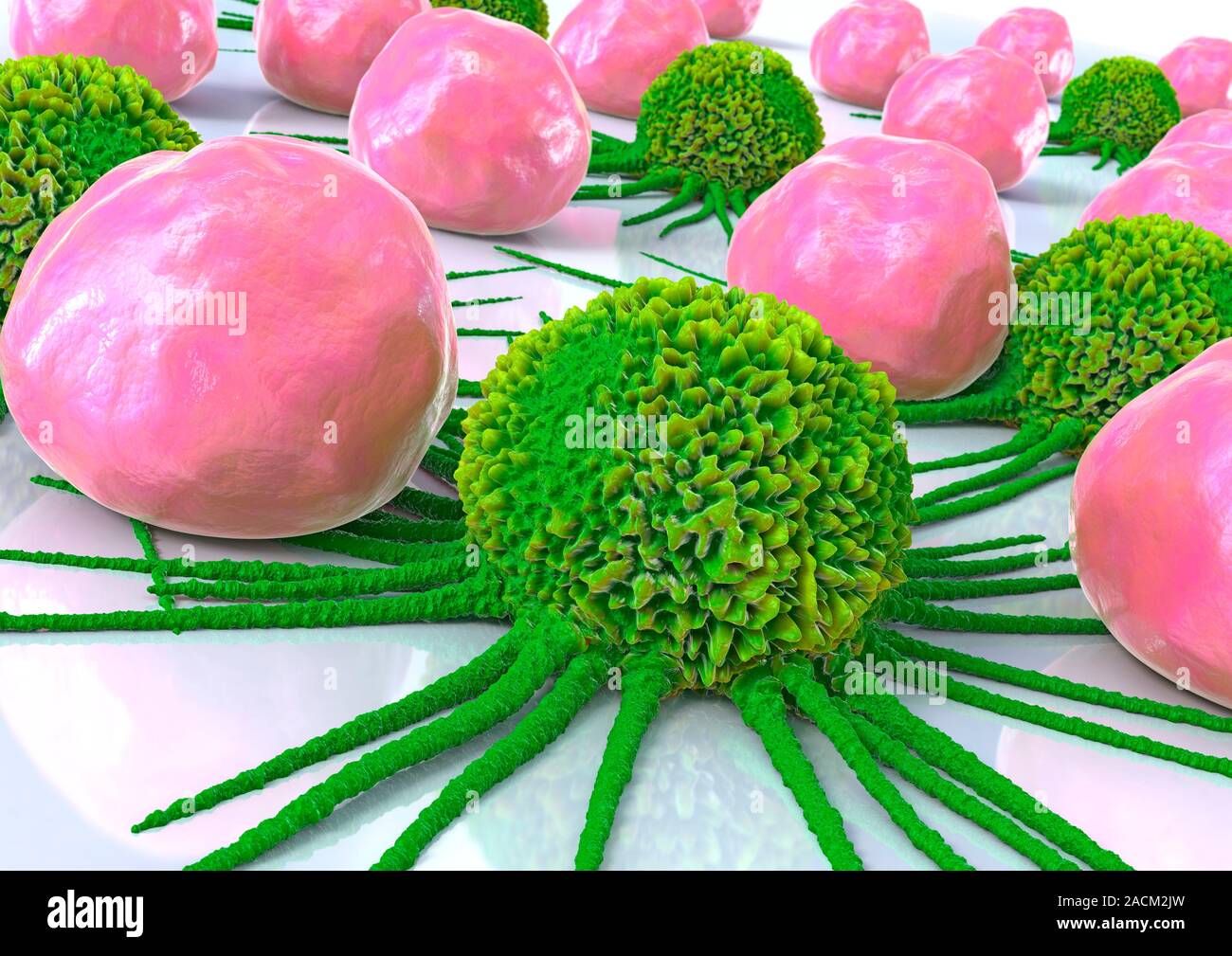 Cancer spreading, conceptual image. Computer artwork showing cancerous ...