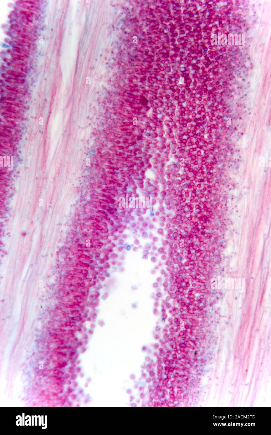 Boletus fungus. Light micrograph of a section through tissue from the ...