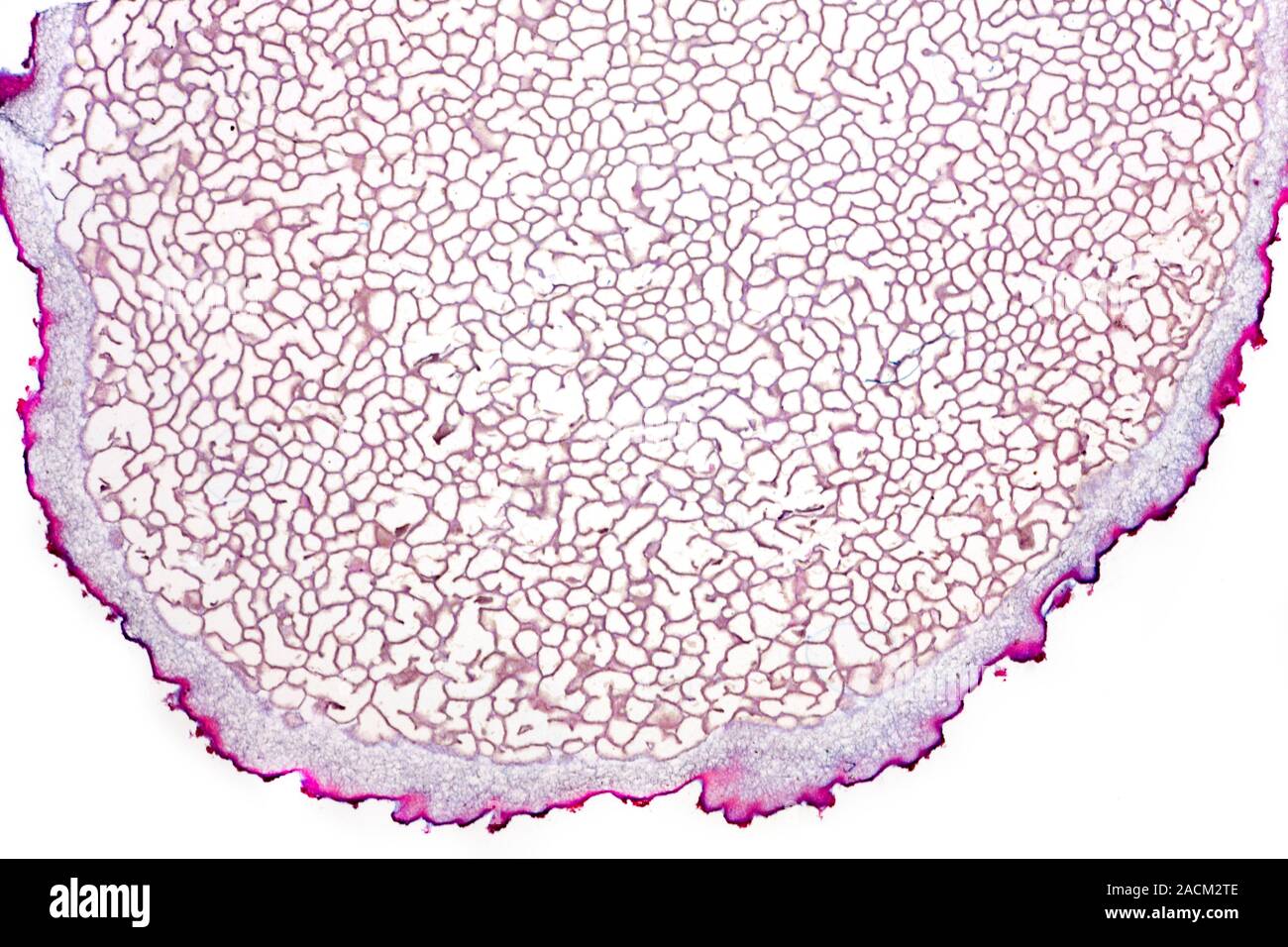 Earth ball fungus. Light micrograph of a section through tissue from ...