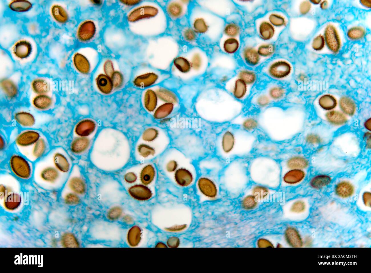 Truffle fungus. Light micrograph of a section through tissue from the ...