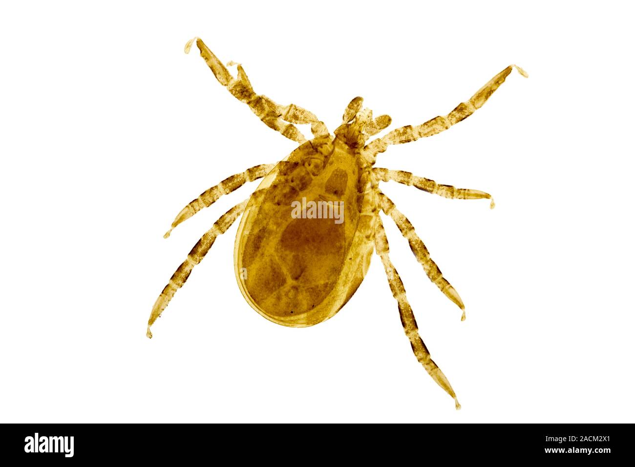 Sheep tick. Light micrograph of a sheep tick (Ixodes ricinus). This is ...