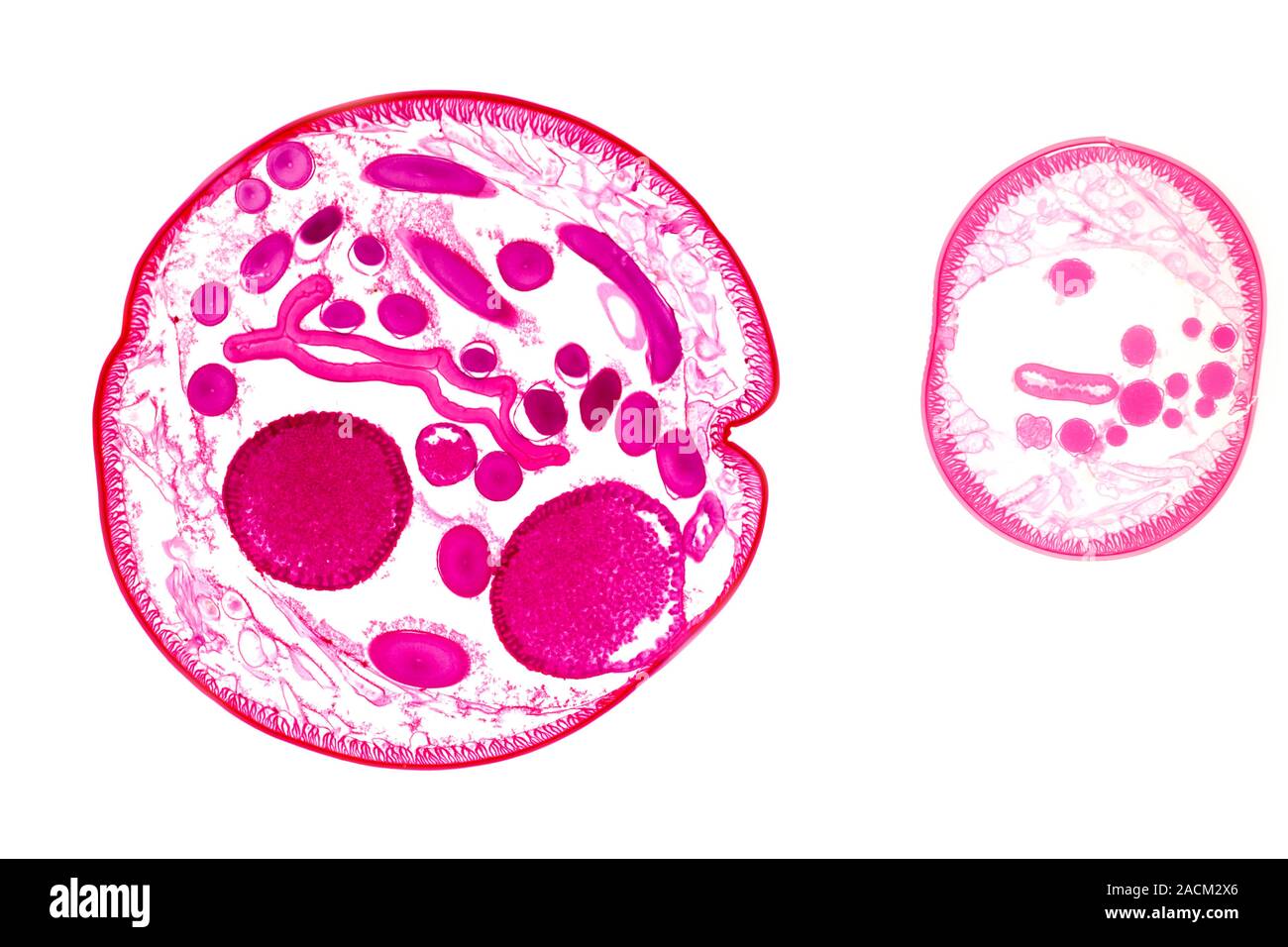 Roundworm Cross Section Biology 108 Lab 9 And 10 | Flashcards