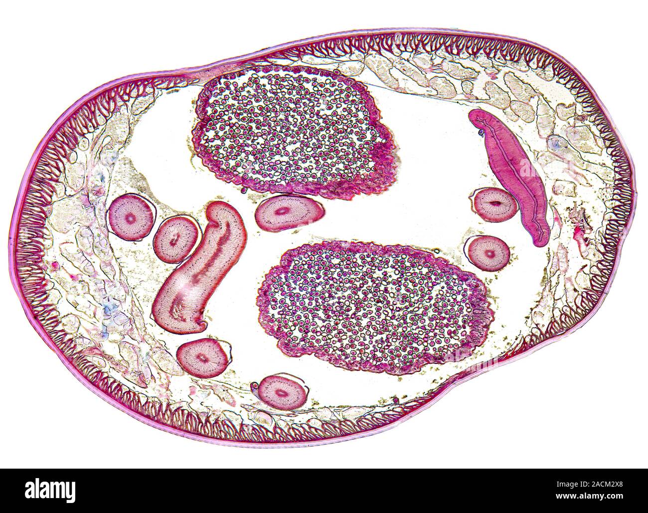 Ascaris roundworm. Light micrograph of a transverse section through a ...