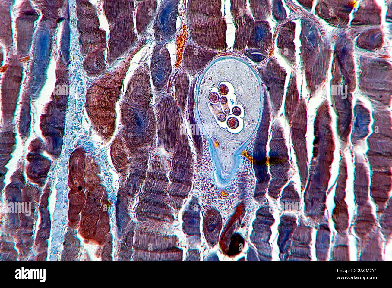 Nematode larval cyst. Light micrograph of a section through muscle ...