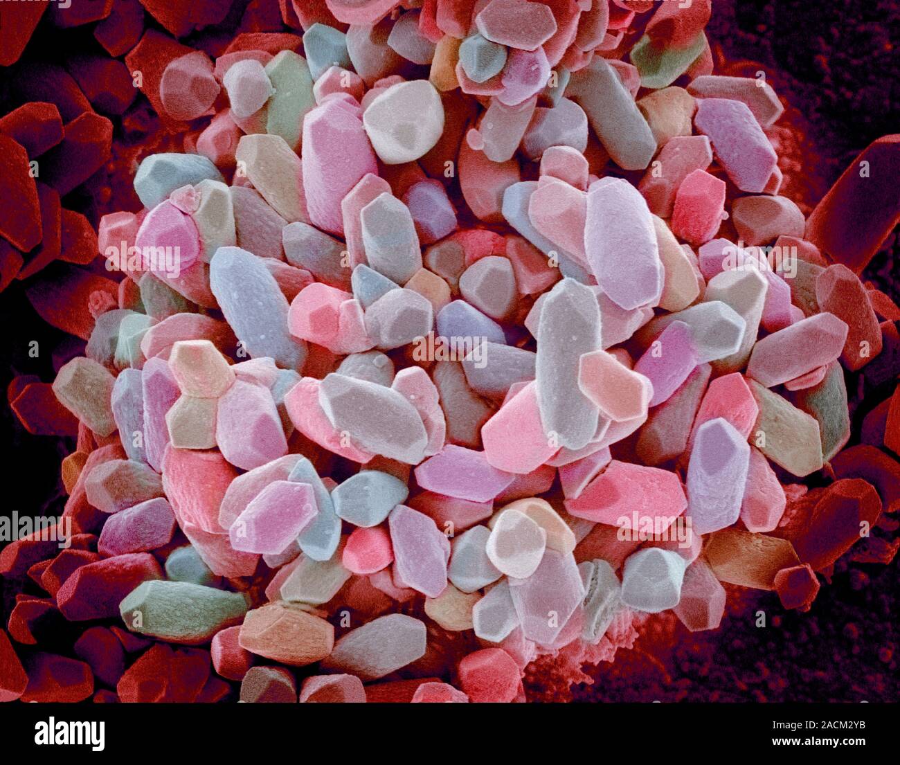 Balancing stone from inner ear. Coloured scanning electron micrograph ...