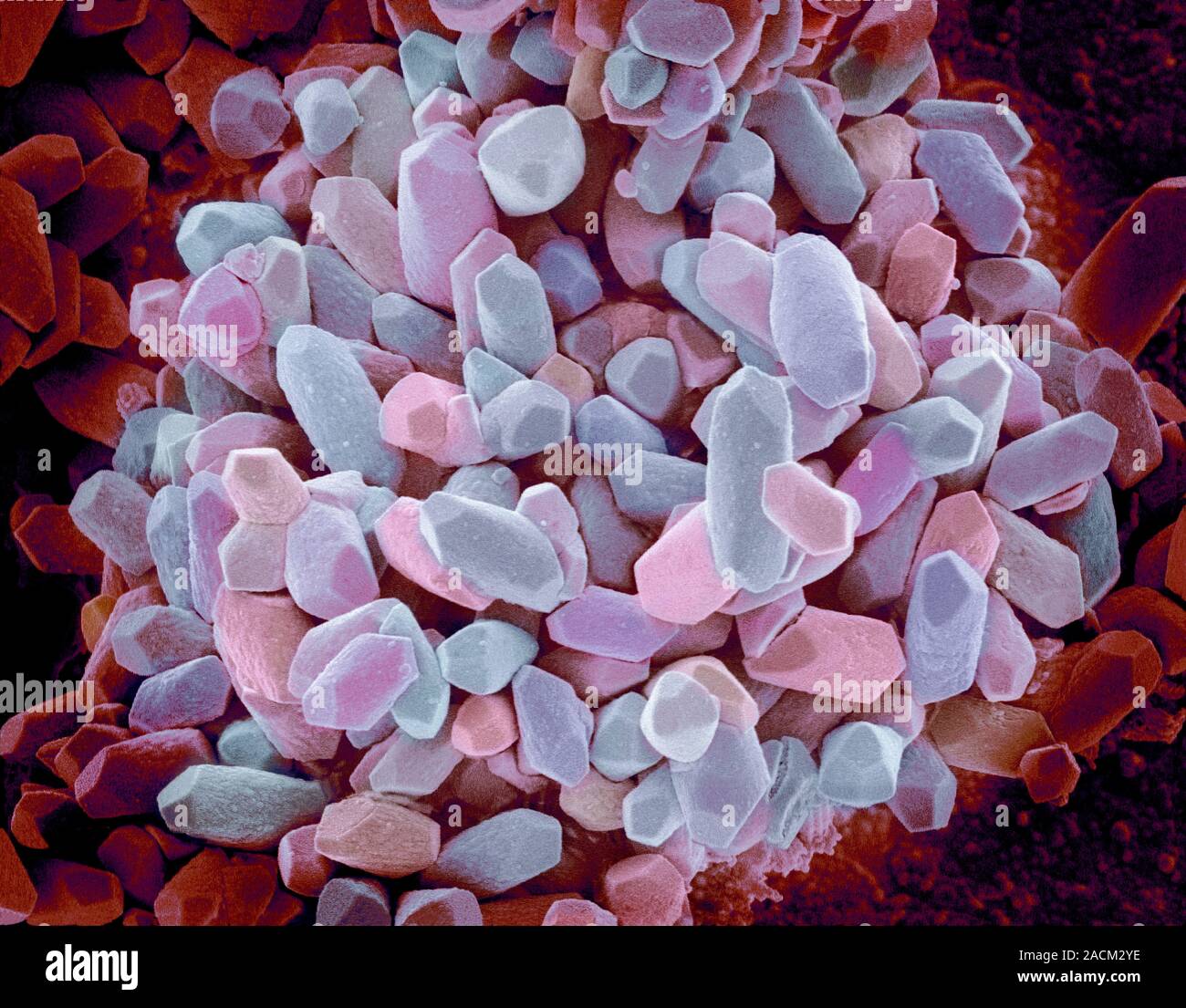 Balancing stone from inner ear. Coloured scanning electron micrograph ...