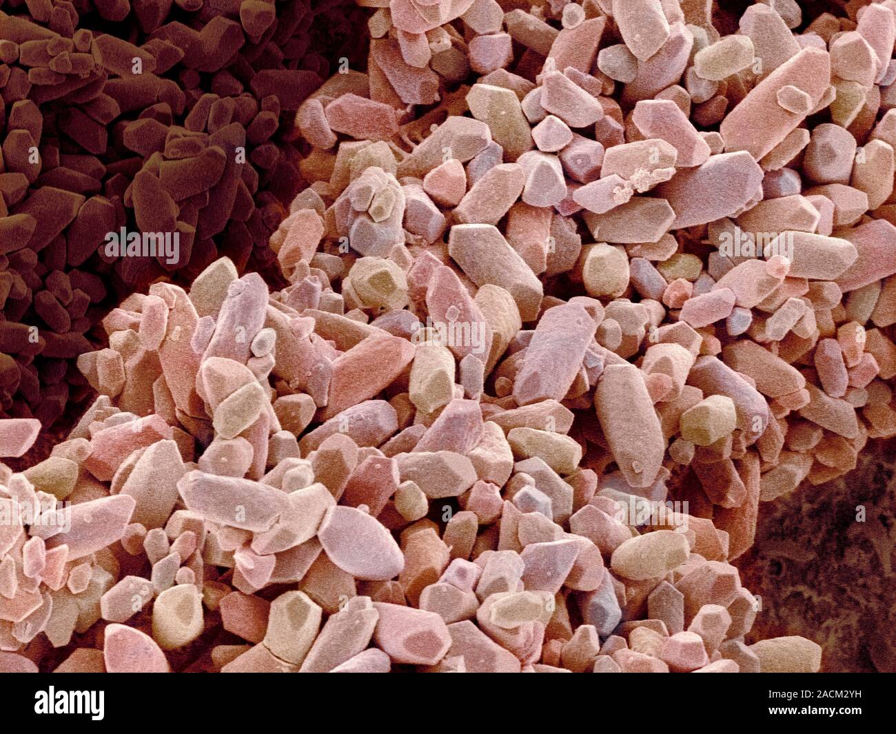Balancing stone from inner ear. Coloured scanning electron micrograph ...