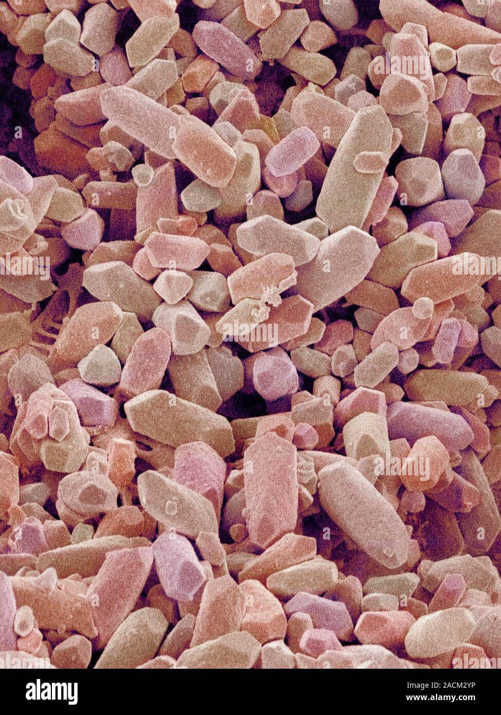 Balancing stone from inner ear. Coloured scanning electron micrograph ...