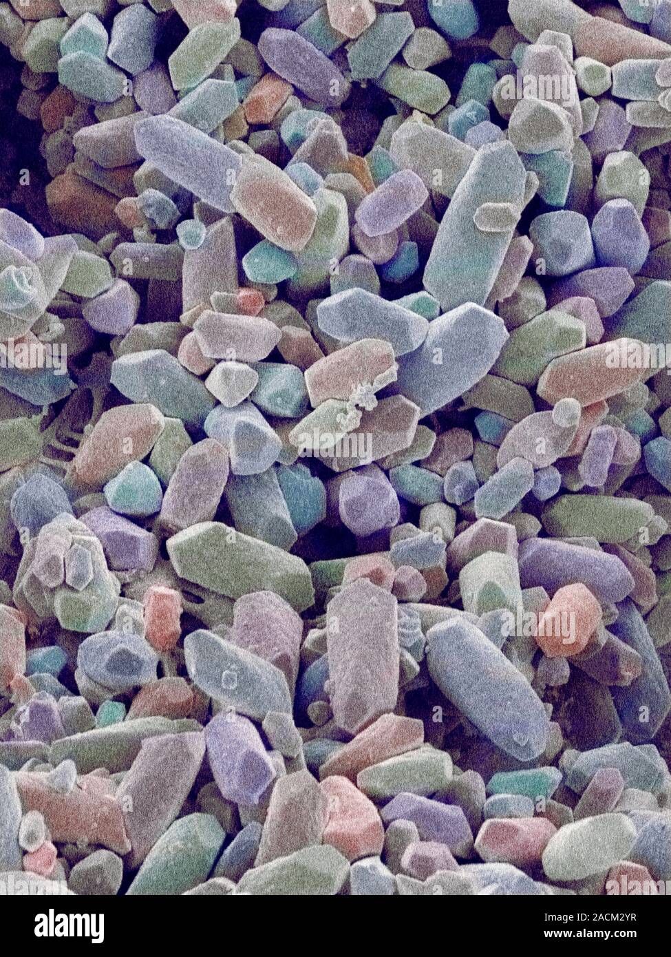 Balancing stone from inner ear. Coloured scanning electron micrograph ...