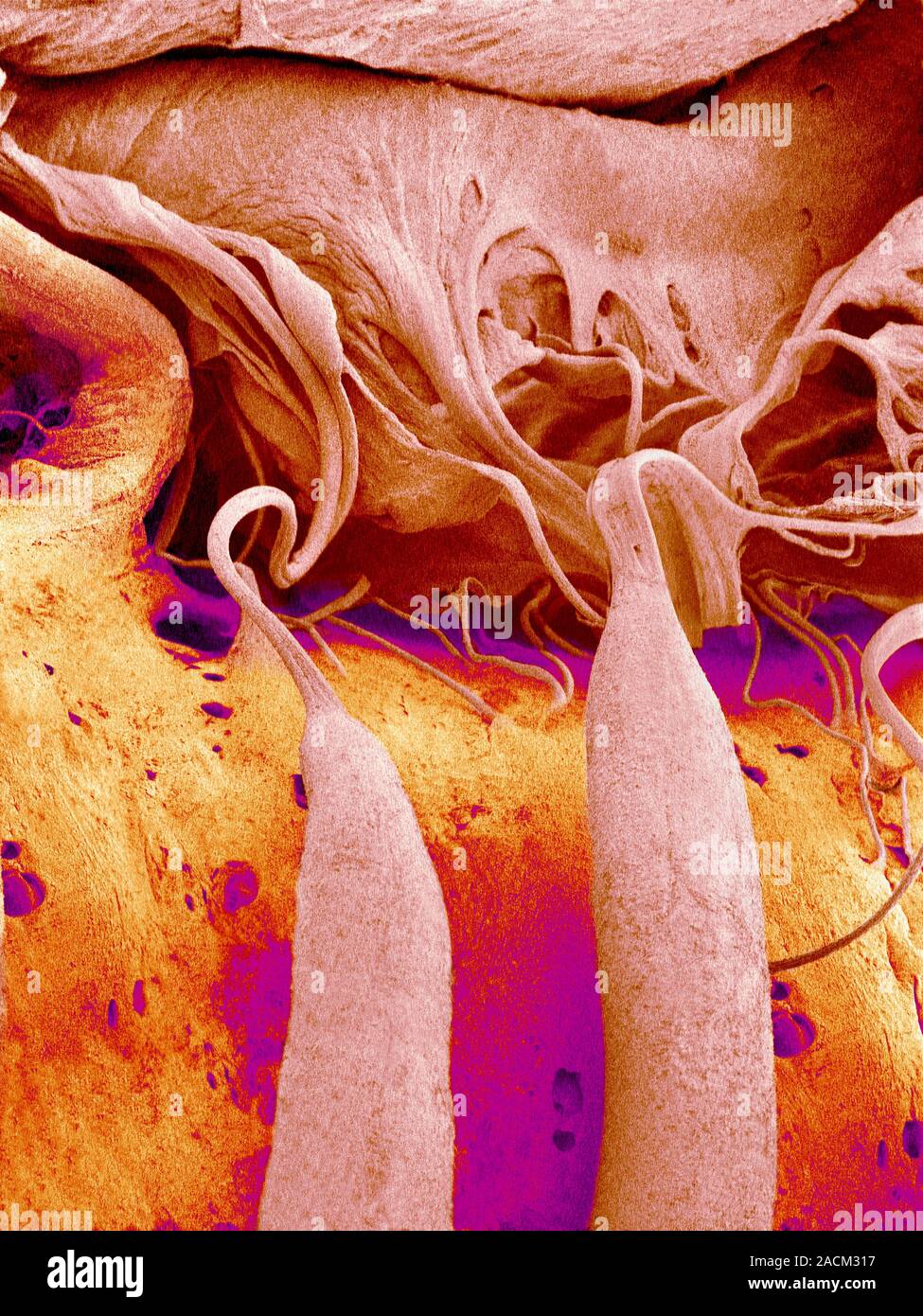 Heart valve and strings, coloured scanning electron micrograph (SEM ...