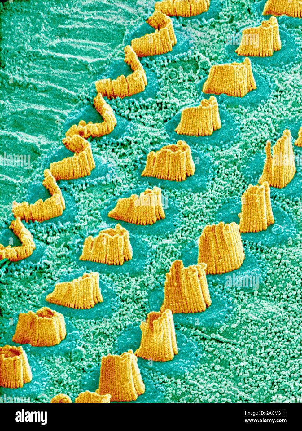 Inner Ear Hair Cells Coloured Scanning Electron Micrograph Sem Of Sensory Hair Cells From The
