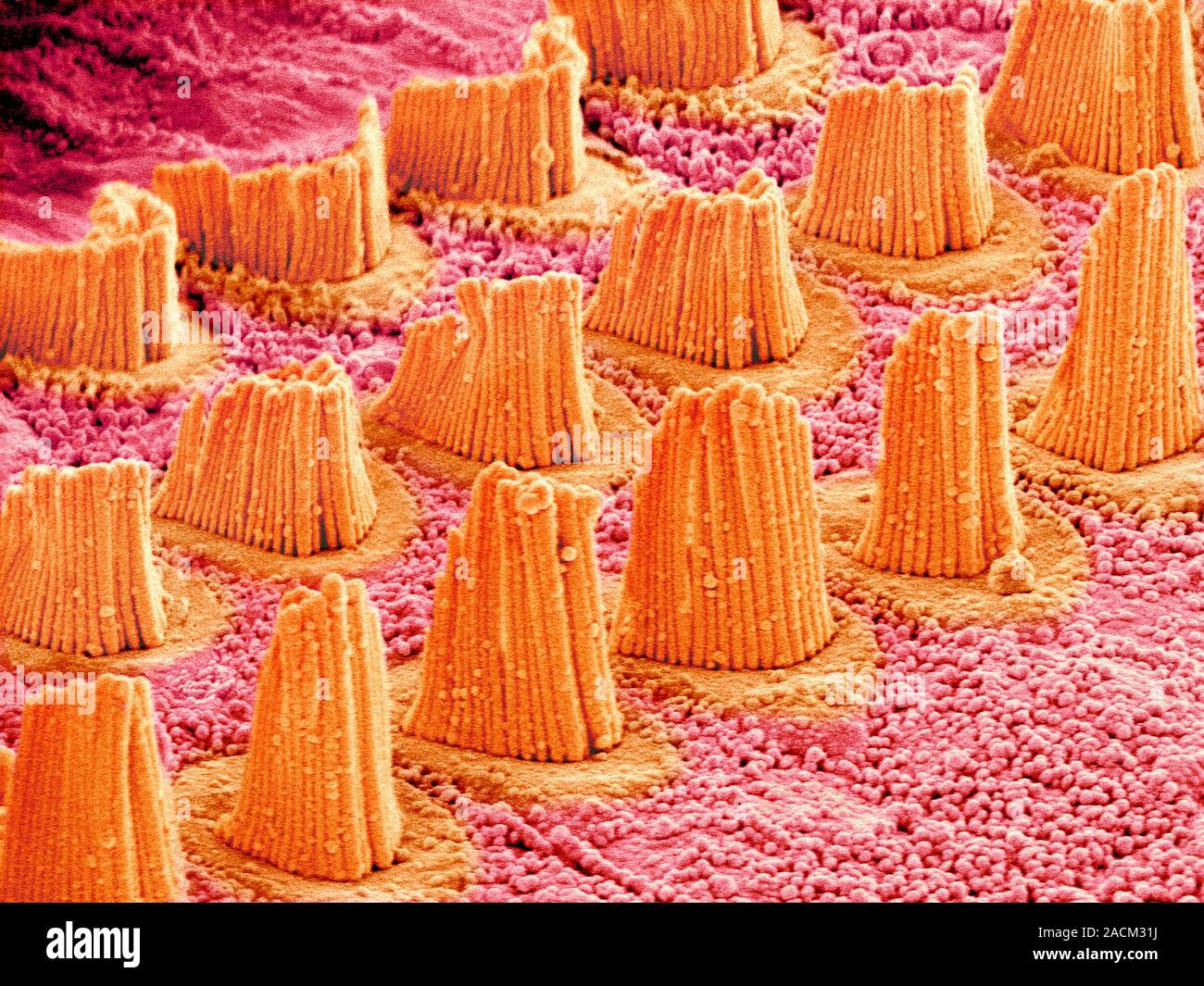 Inner ear hair cells. Coloured scanning electron micrograph (SEM) of ... Inner ear hair cells. Coloured scanning electron micrograph (SEM) of ...