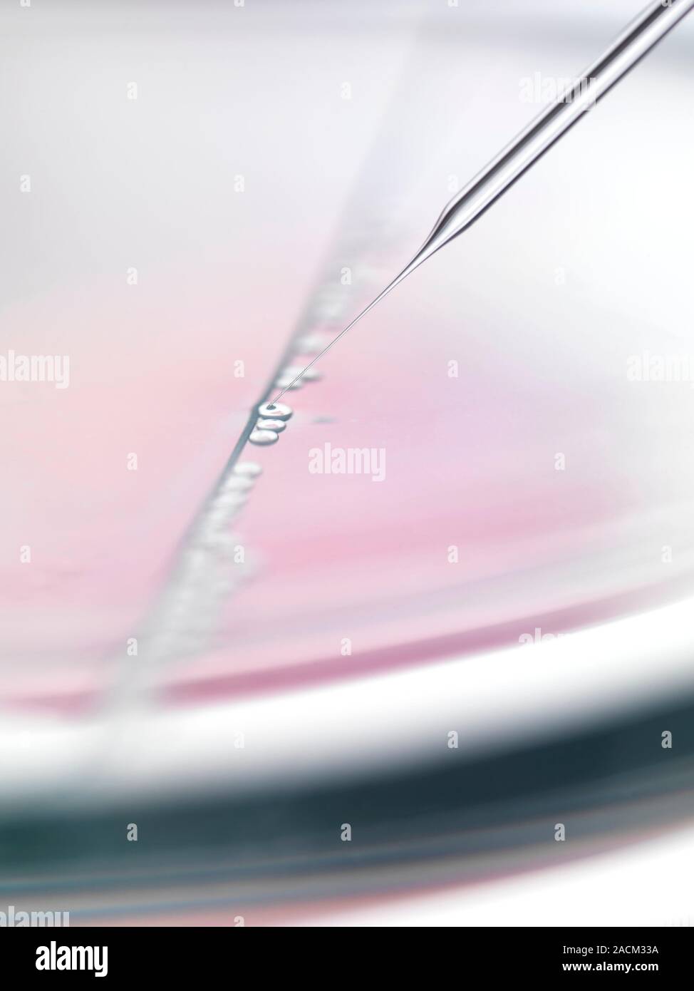 Stem cell research. Nuclear transfer being carried out on several ...