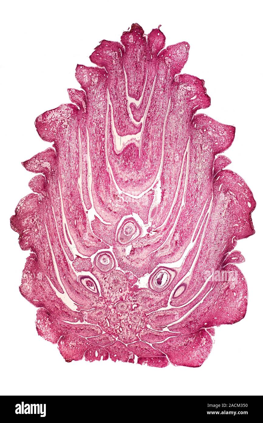 Female pine cone. Light micrograph of a section through a young ovulate ...