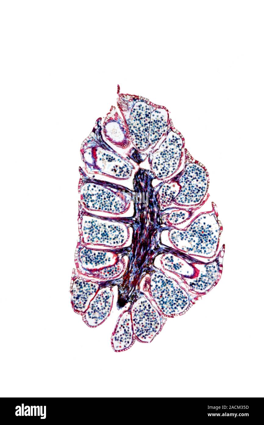 Male pine cone. Light micrograph of a section through a male pine ...