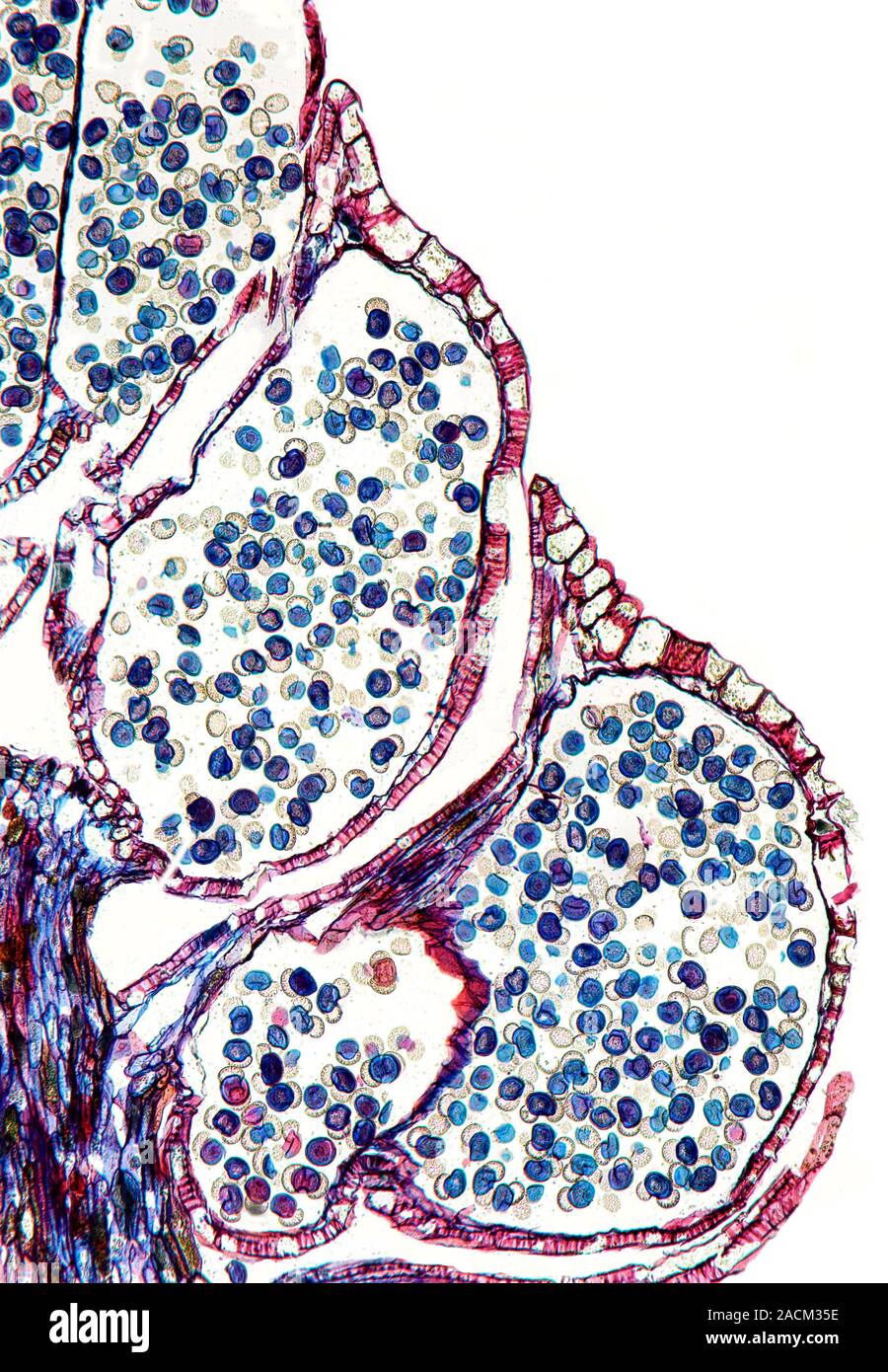 Male pine cone. Light micrograph of a section through a male pine ...
