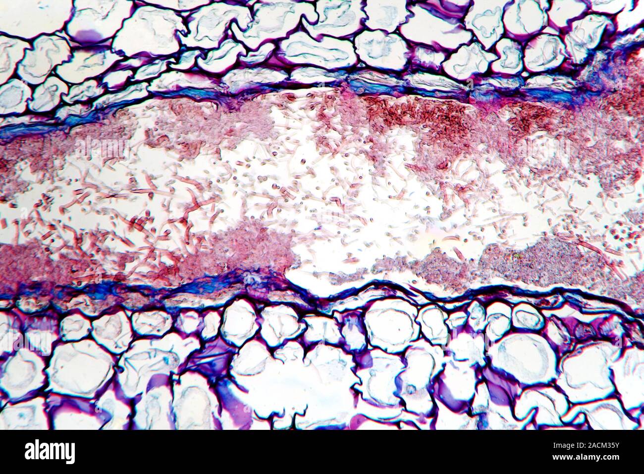 Grey mould fungus. Light micrograph of a section through onion tissue ...