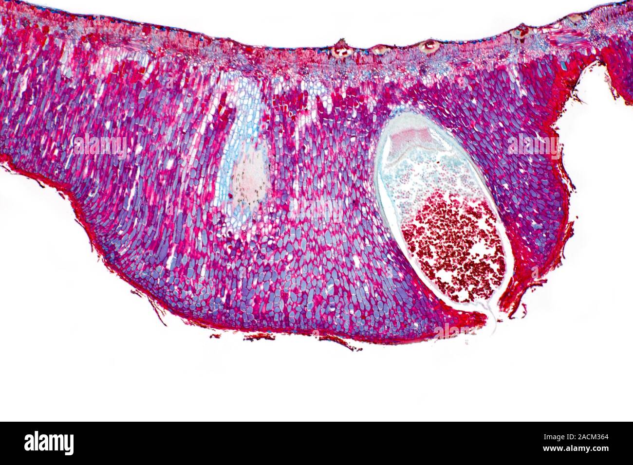 Pear rust fungus. Light micrograph of a section through tissue from a ...