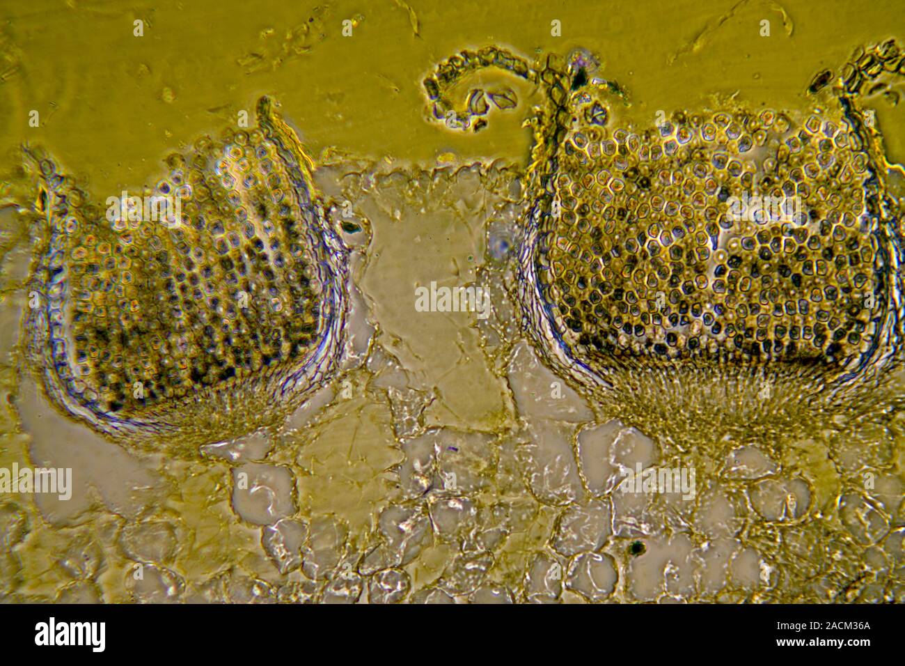 Rust fungus in a leaf. Light micrograph of a section through a barberry ...