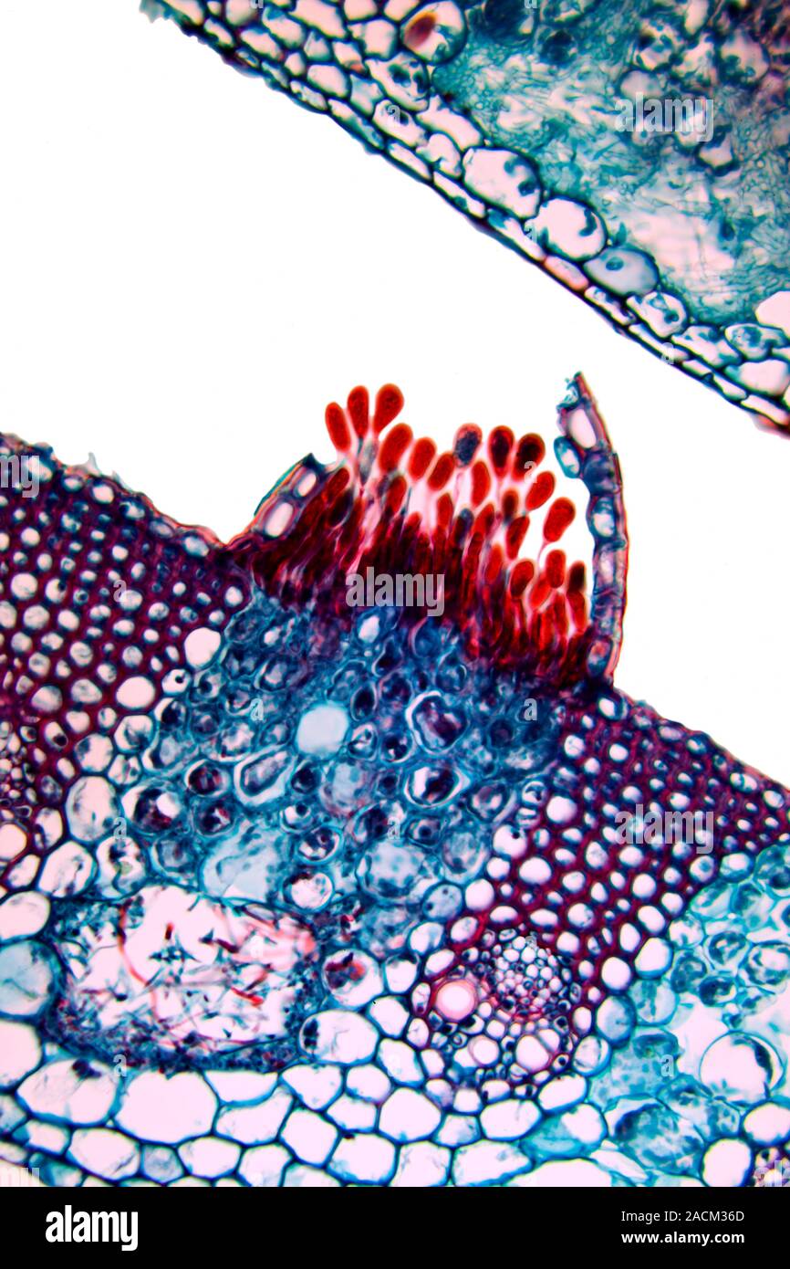 Rust fungus in a leaf. Light micrograph of a section through a wheat ...