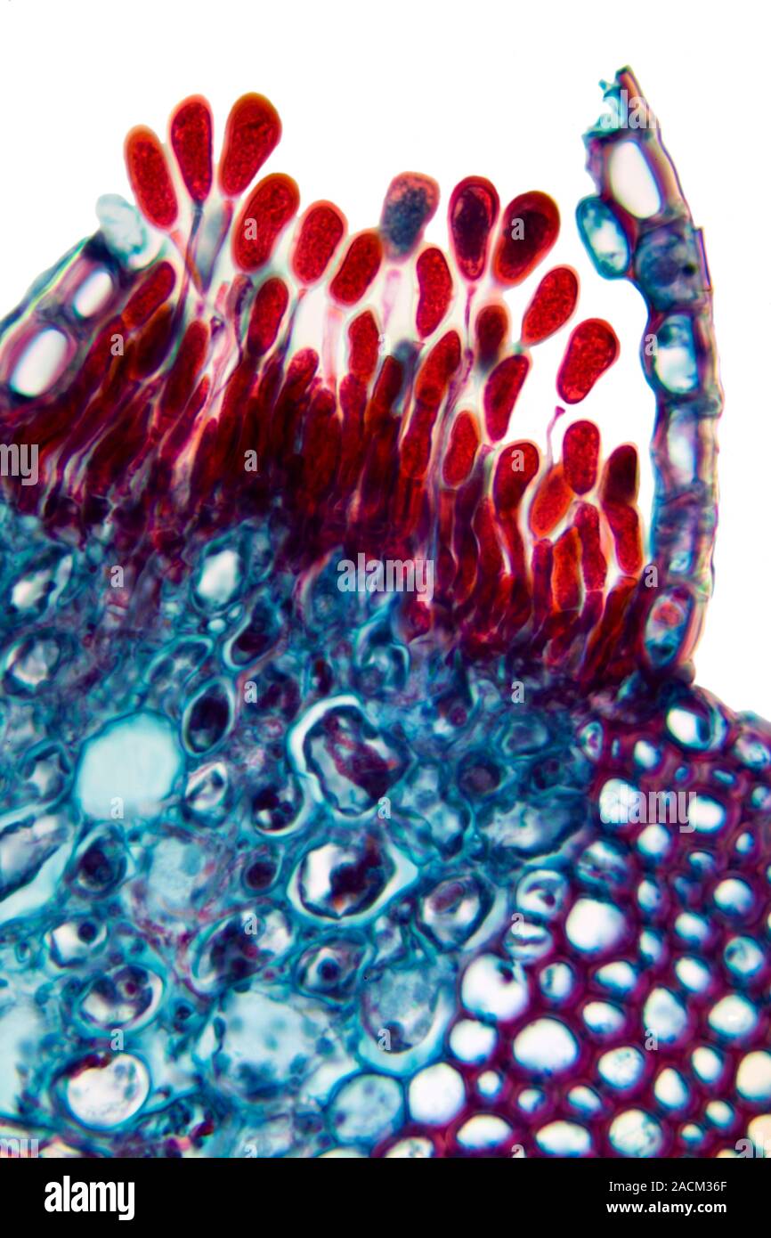 Rust fungus in a leaf. Light micrograph of a section through a wheat ...