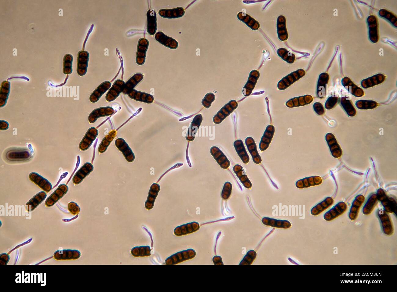 Bramble rust fungus spores. Light micrograph of teliospores from the ...