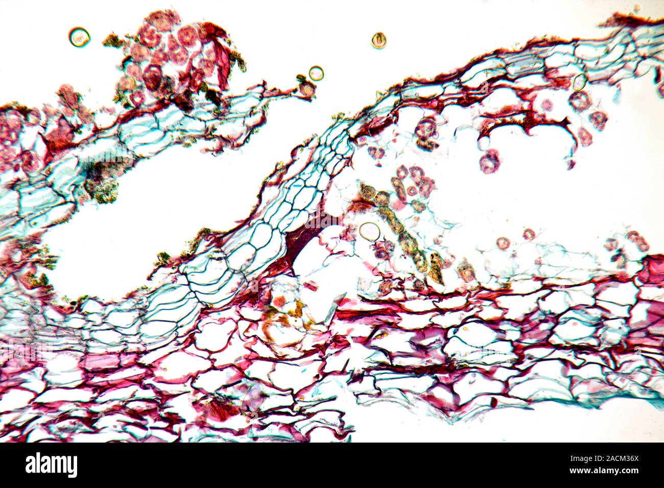 Powdery scab infection. Light micrograph of a section through a potato ...