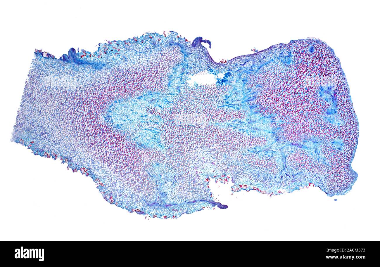 Black scab infection. Light micrograph of a section through a potato ...