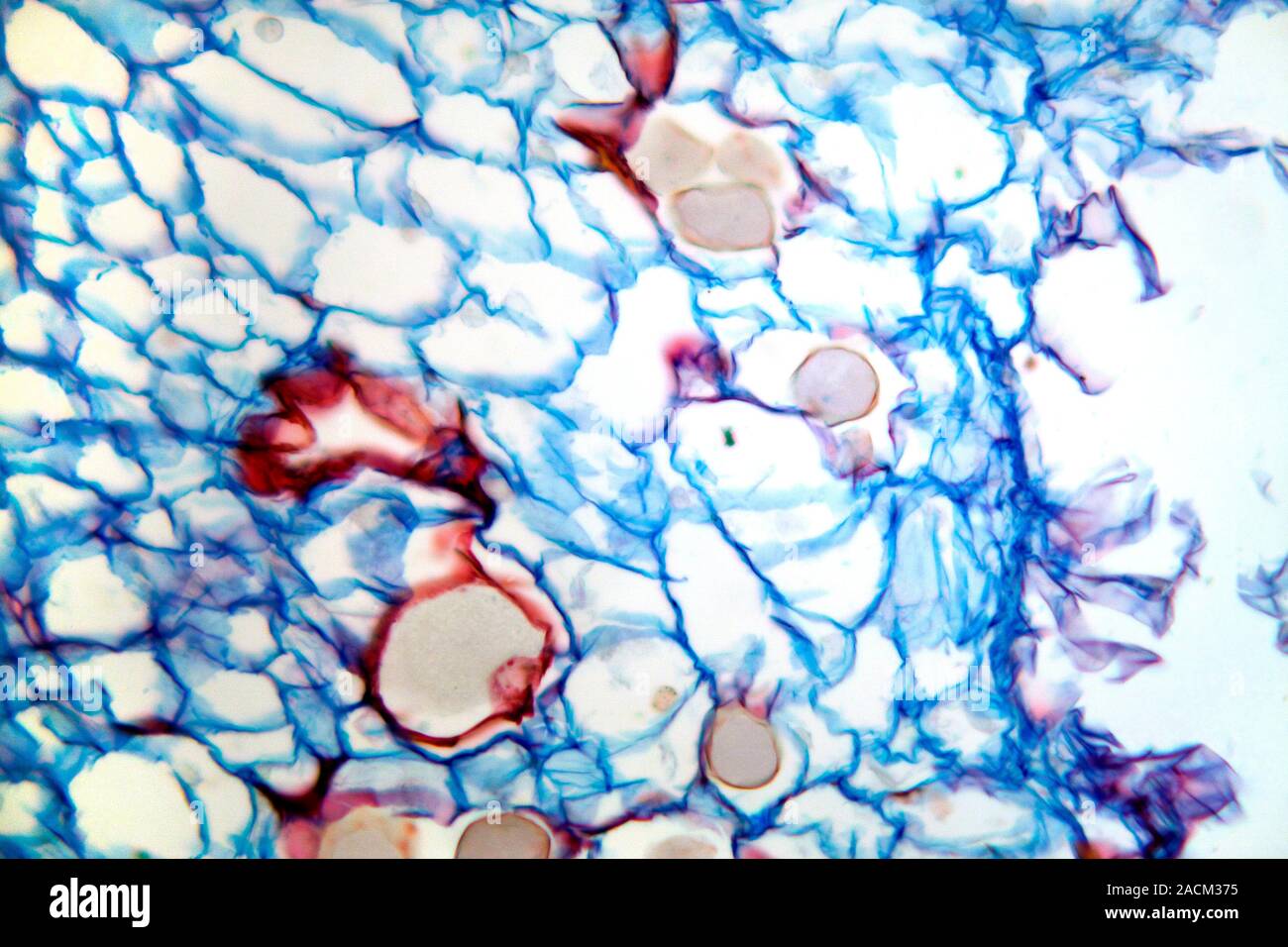 Black scab infection. Light micrograph of a section through a potato ...
