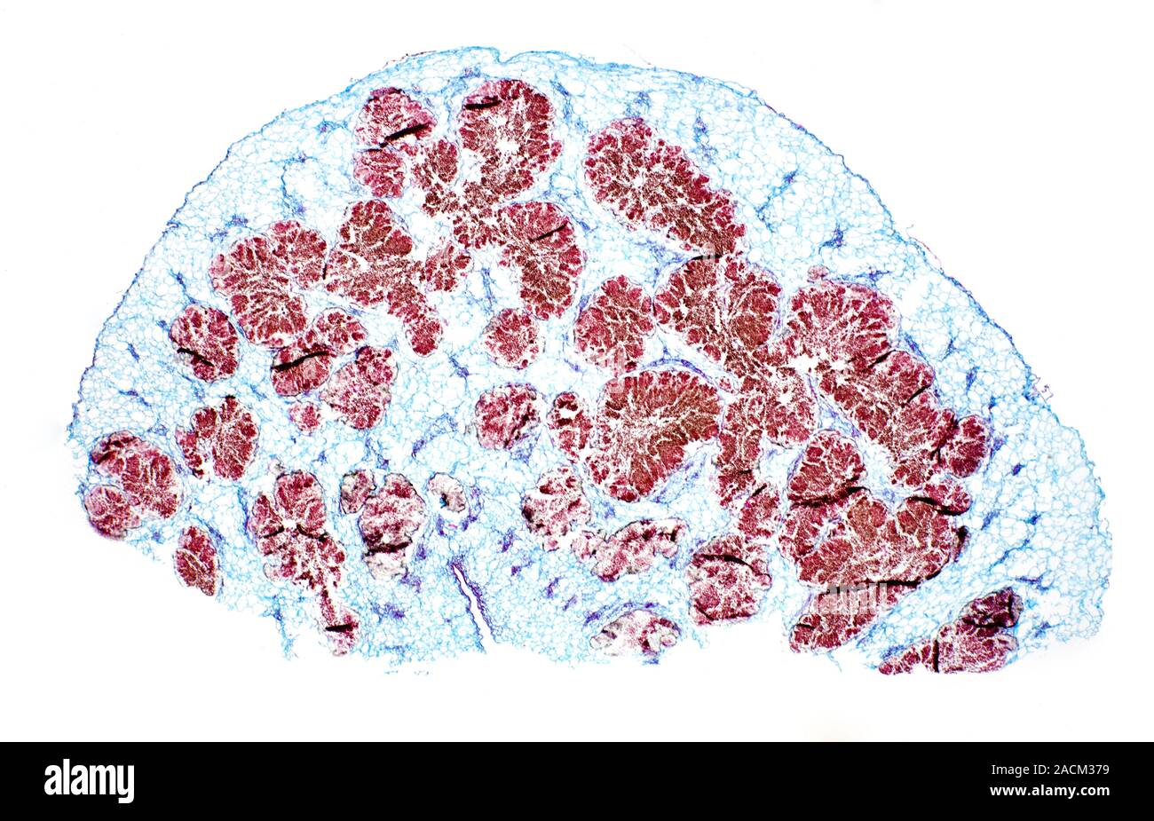 Corn smut infection. Light micrograph of a section through tissue from ...