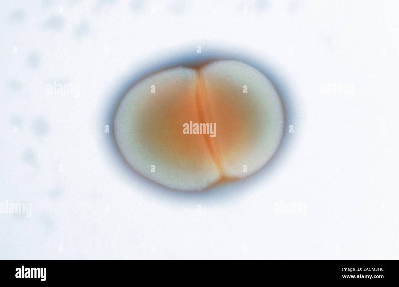Enterococcus faecalis. Coloured transmission electron micrograph (TEM ...