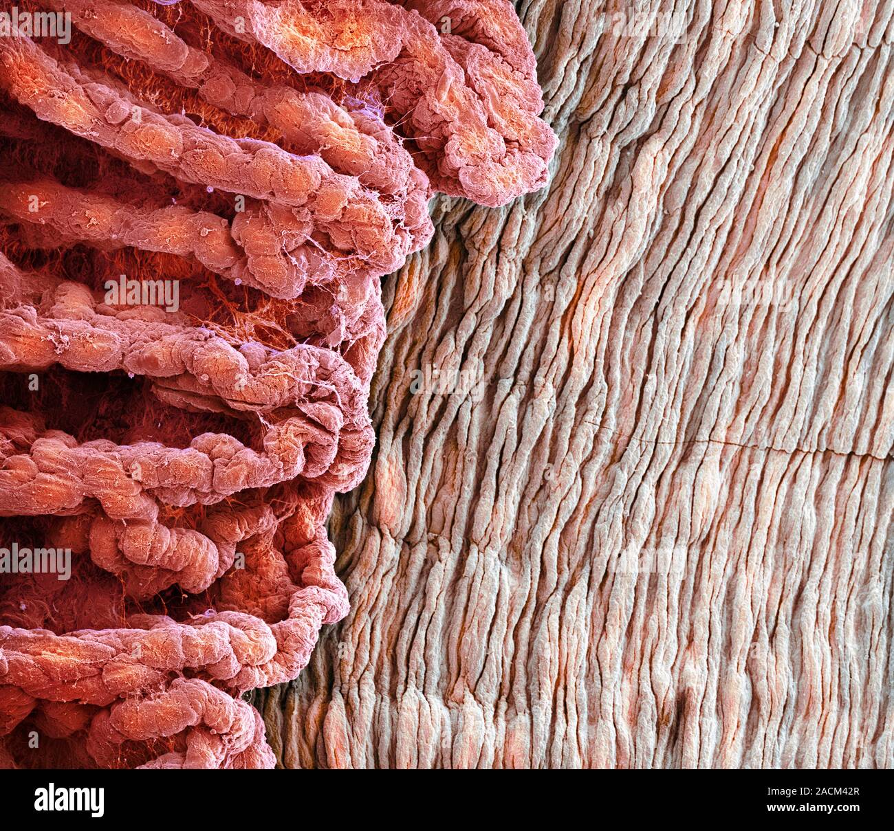 Eye anatomy. Coloured scanning electron micrograph (SEM) showing part ...