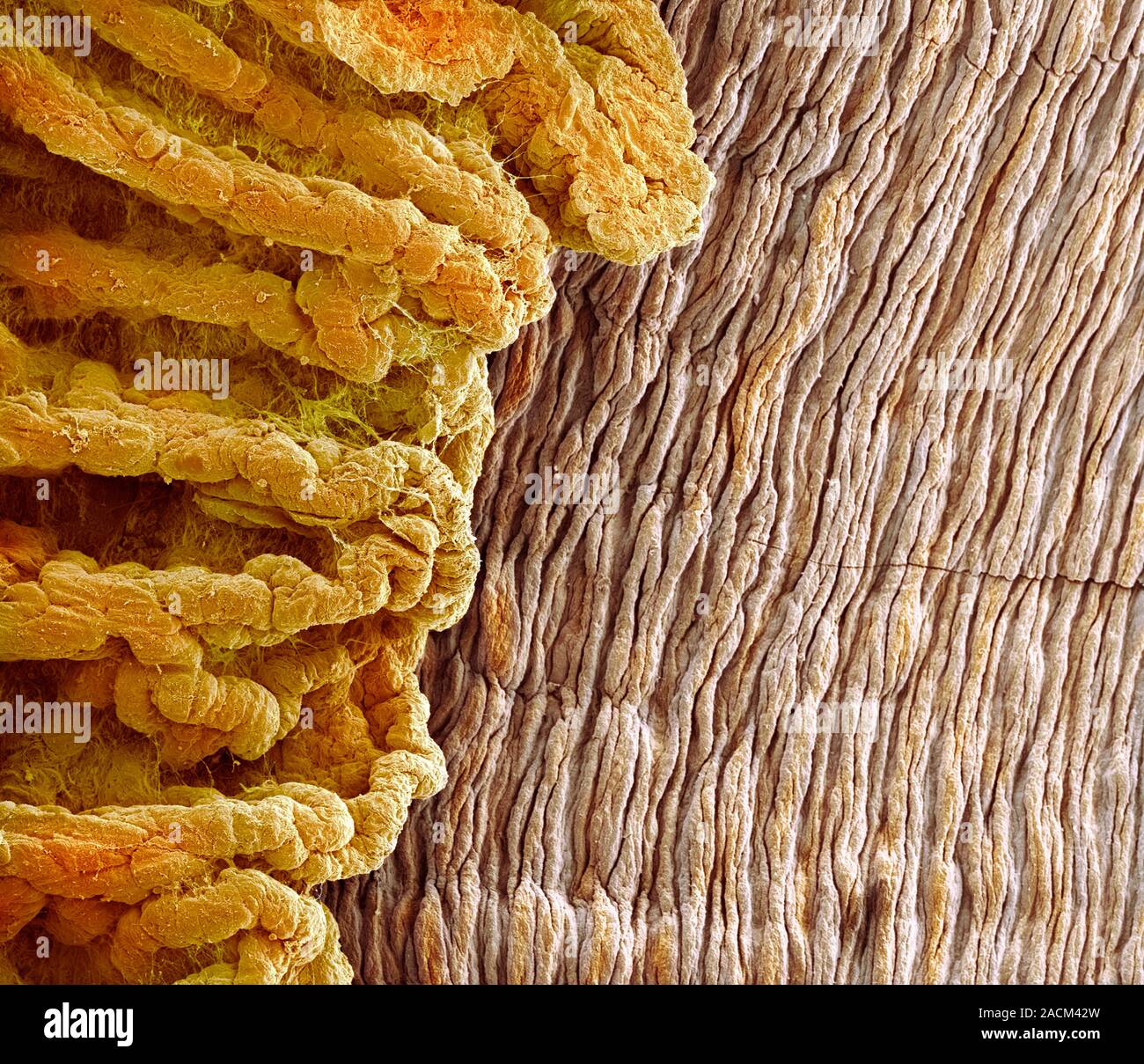 Eye anatomy. Coloured scanning electron micrograph (SEM) showing part of the ciliary body ...
