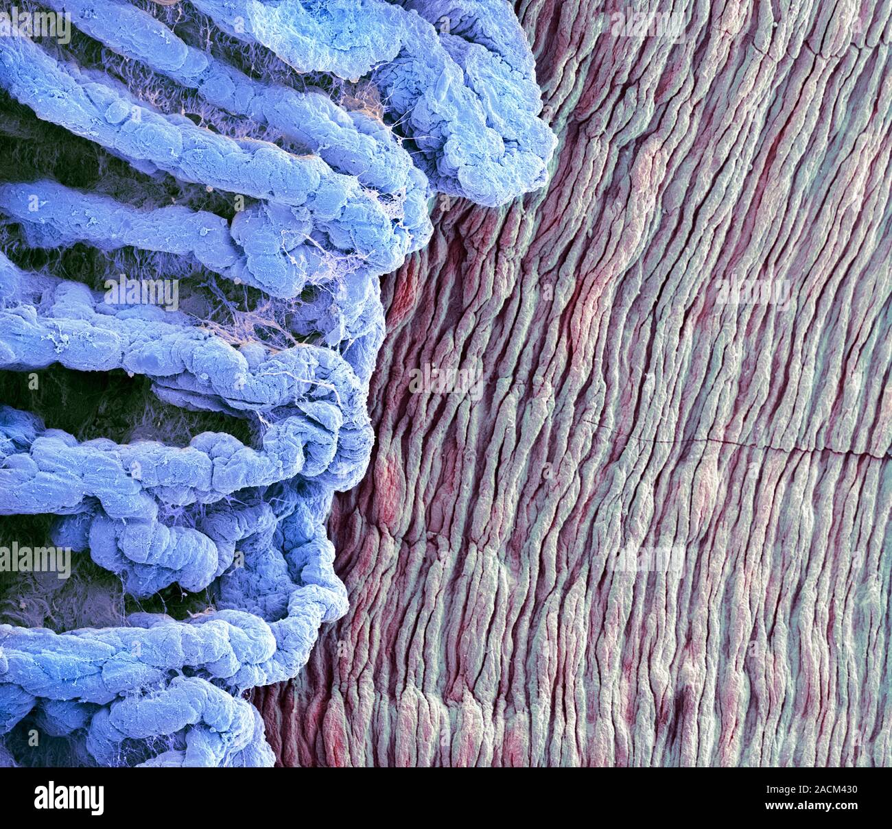 Eye anatomy. Coloured scanning electron micrograph (SEM) showing part ...