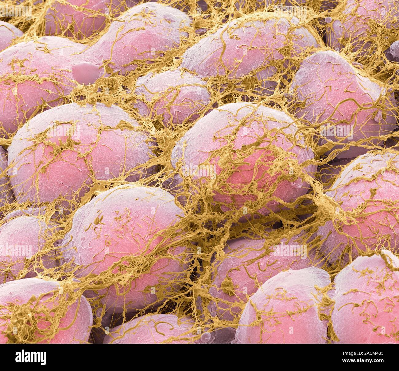 Fat tissue. Coloured scanning electron micrograph (SEM) of fat cells ...