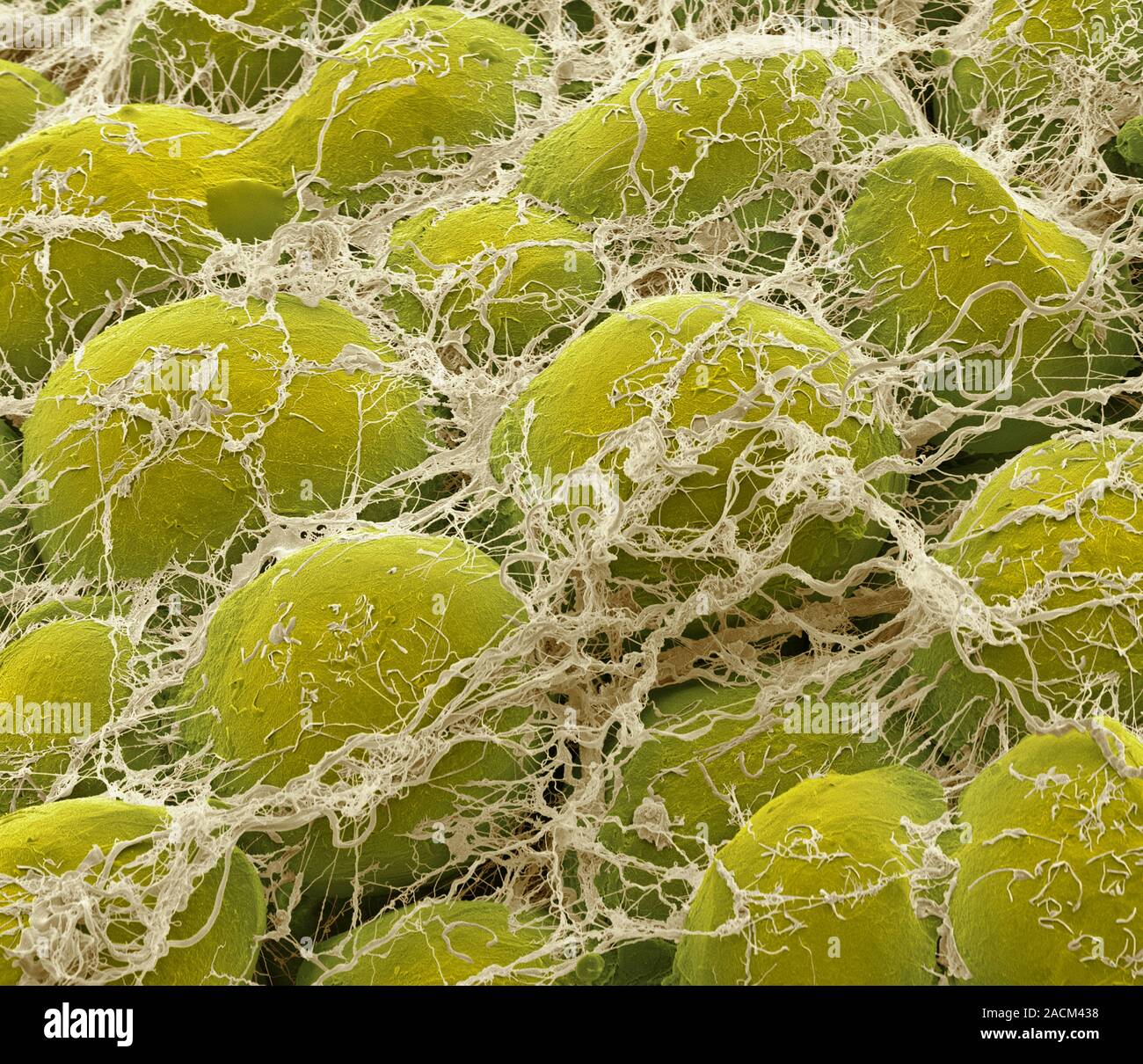 Fat tissue. Coloured scanning electron micrograph (SEM) of fat cells ...
