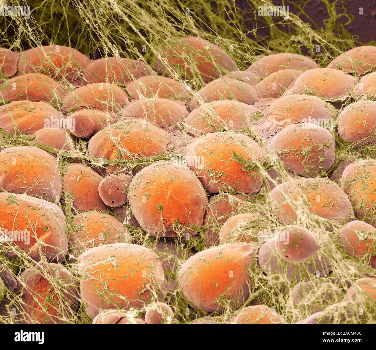 Fat tissue. Coloured scanning electron micrograph (SEM) of fat cells ...