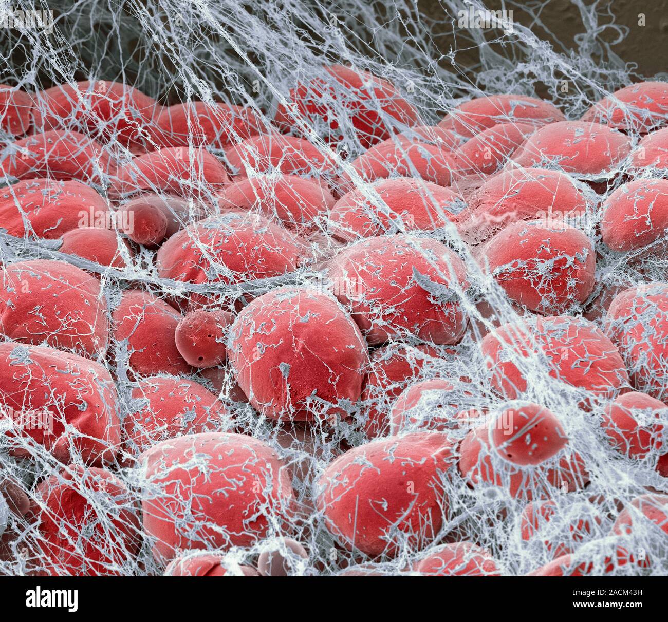 Fat tissue. Coloured scanning electron micrograph (SEM) of fat cells ...