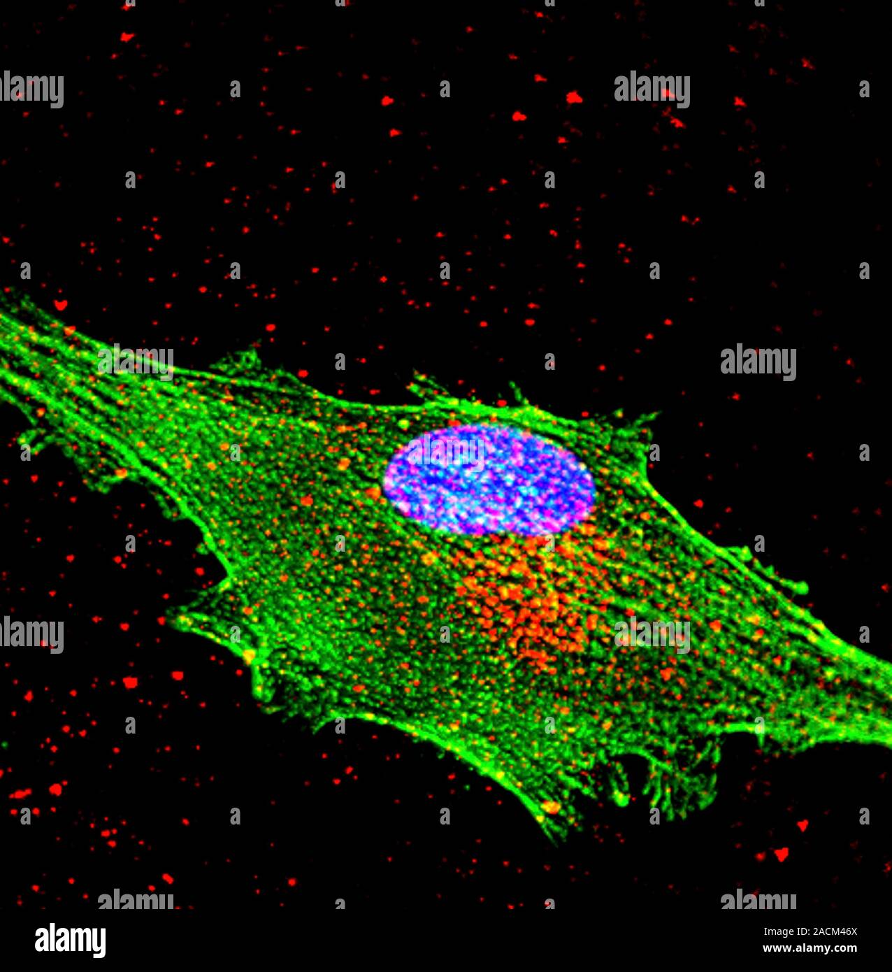 Parkinson's disease research. Fluorescent deconvolution micrograph of a ...