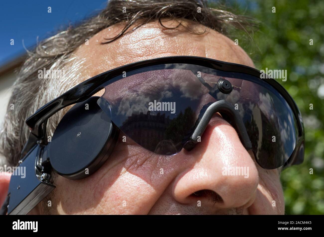 Argus II artificial retina user. The Argus II was developed by US ...