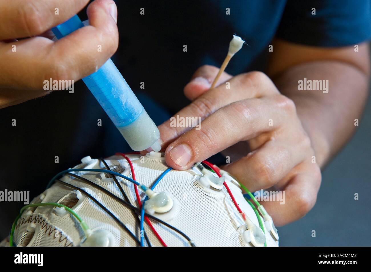 Thought-controlled wheelchair. Researcher attaching EEG electrodes to a ...