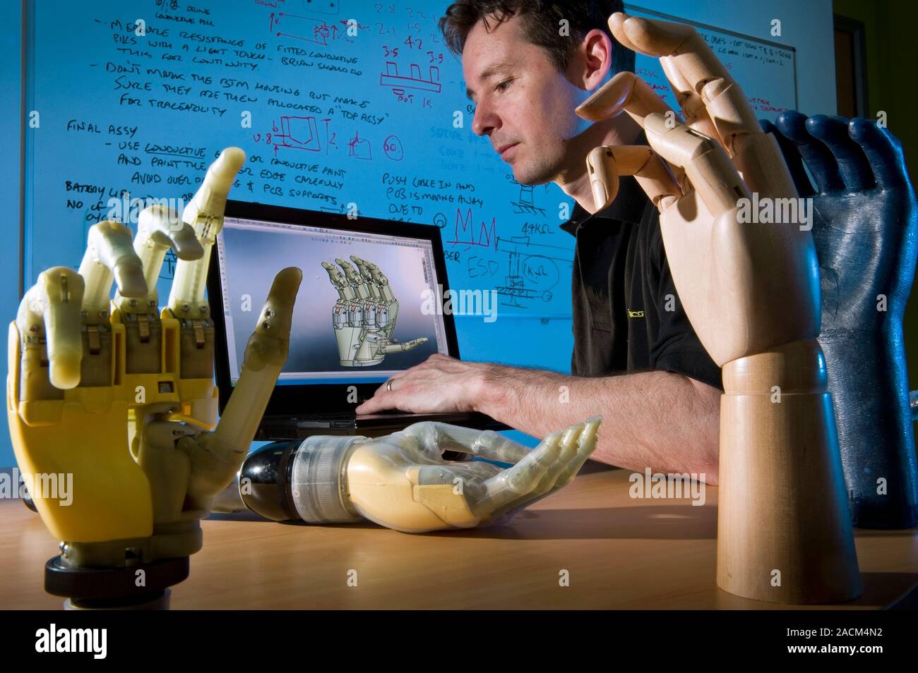 i-LIMB bionic hand research. The i-LIMB range of bionic hands was ...